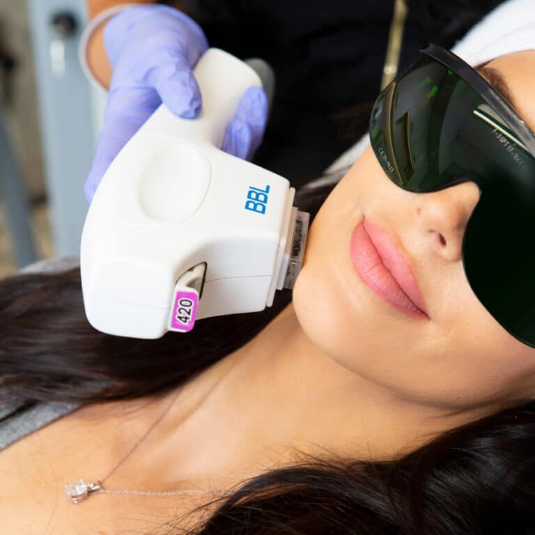 What Is BroadBand Light (BBL) Therapy and How Does It Work?