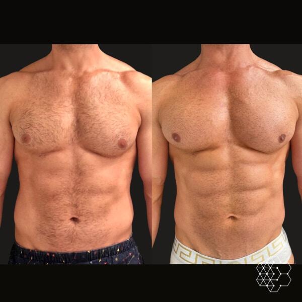 Build The Body You Want - Skin Technique