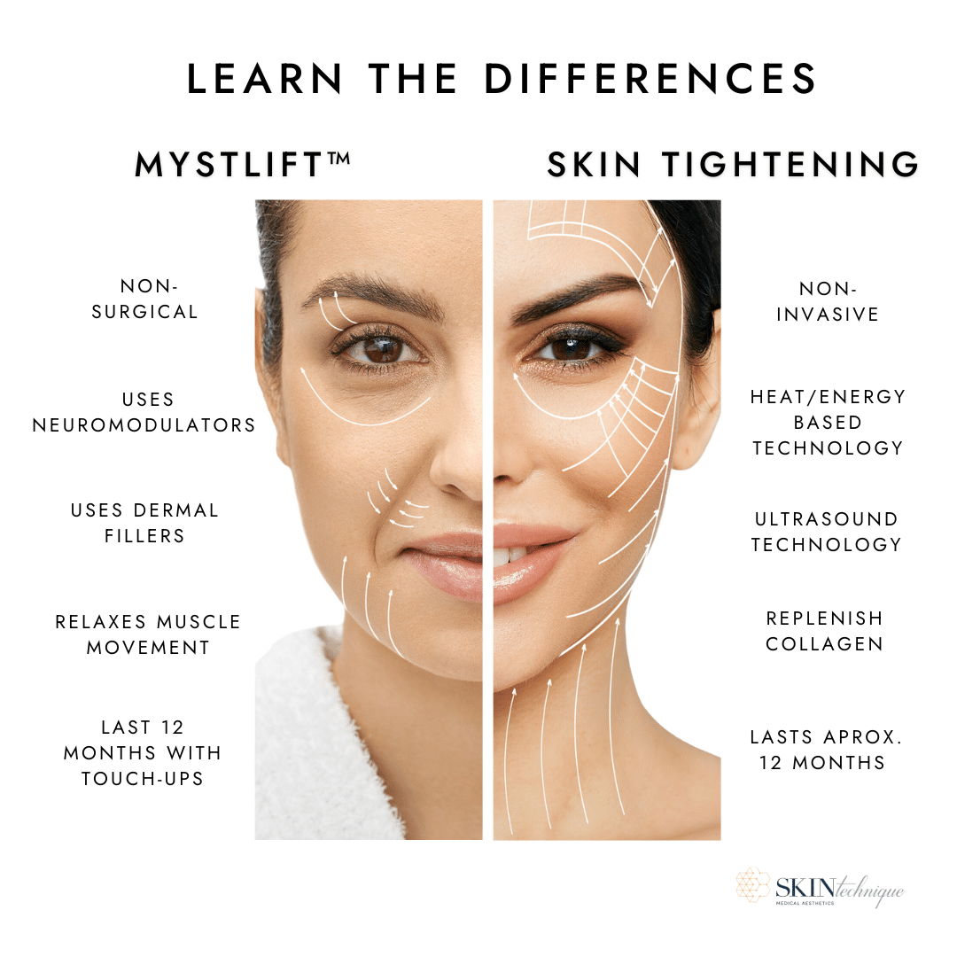MystLift vs. Skin Tightening Treatments: A Guide to Anti-Aging ...