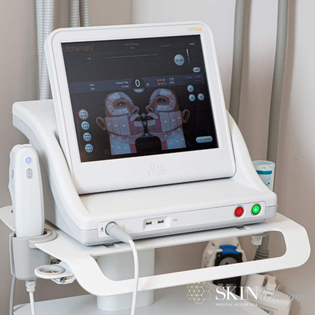 The Before and After of Ultherapy: Skin Technique’s Guide - Vancouver